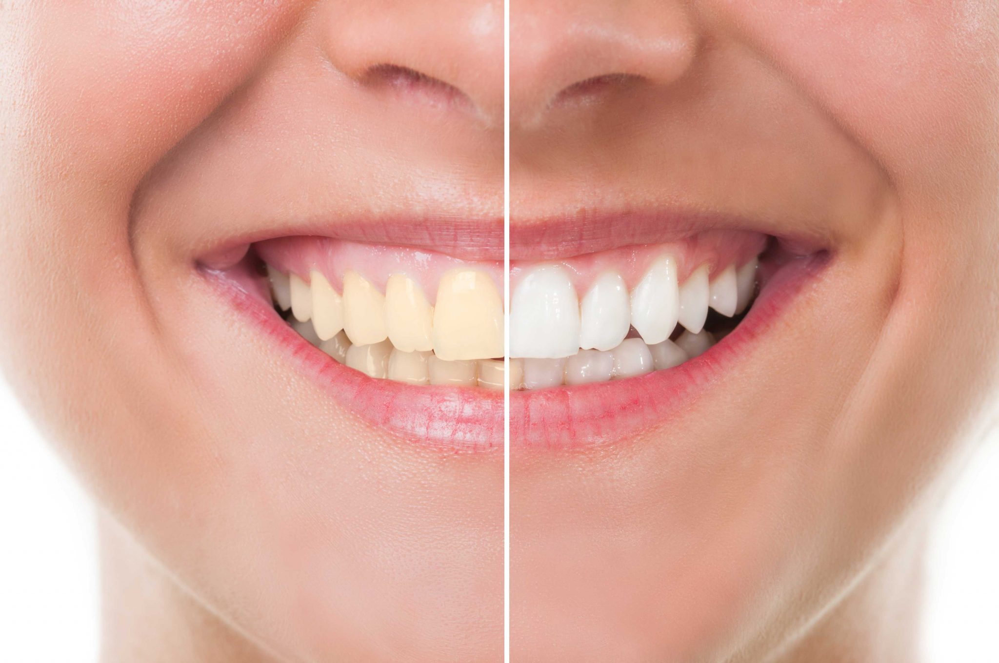 Cosmetic Dentistry | Howe Dental | Vancouver, B.C